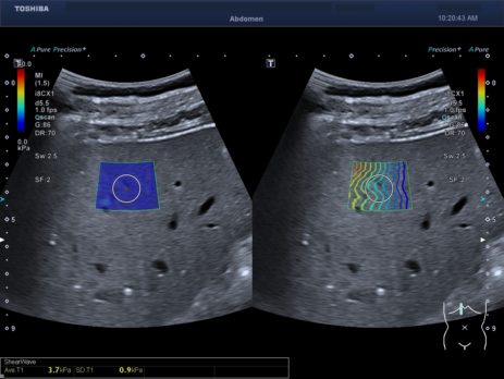 Ultrasonograph Toshiba Aplio i800 - Institut Imagerie Carouge Centre