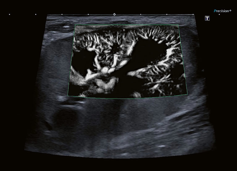 Ultrasonograph Toshiba Aplio i800 - Institut Imagerie Carouge Centre